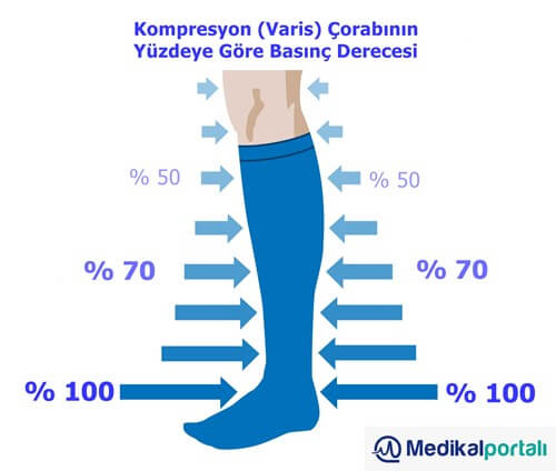 Varis Çorabı Nedir? Neden Kullanılır, Ne İşe Yarar, Tedavide Eder mi ... Varis Çorabı Nedir? Neden Kullanılır, Ne İşe Yarar, Tedavide Eder mi ...
